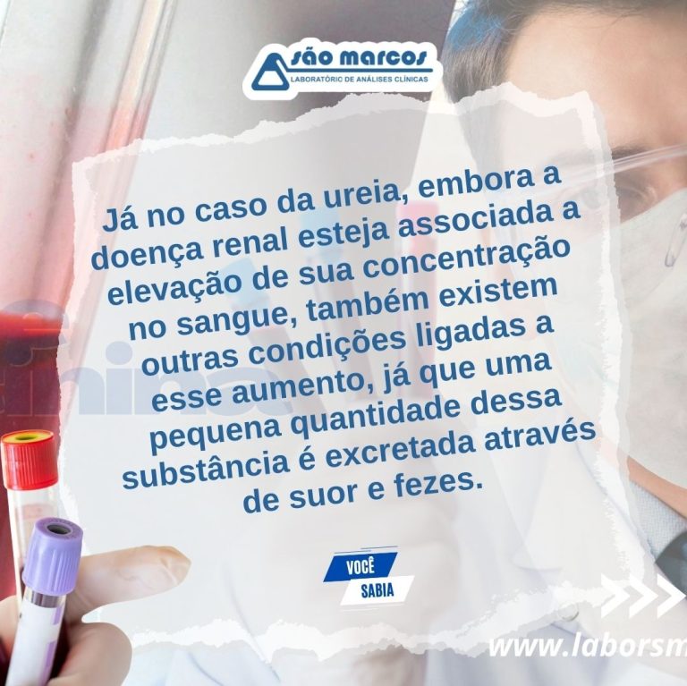 Saiba como é feito o exame de ureia e creatinina - Laboratório São Marcos
